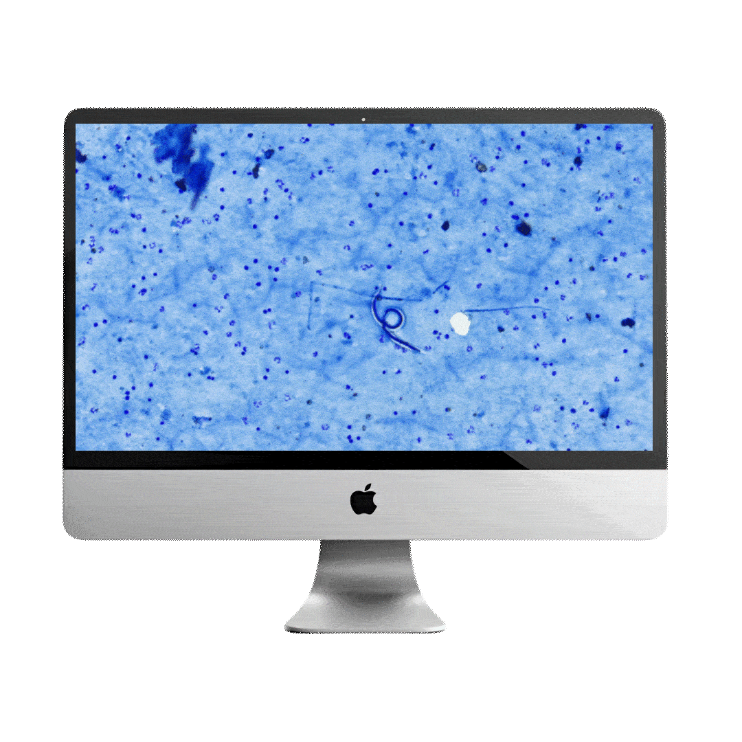 Micalys Whole Slide Scanner | Digital Microscope - Medprime