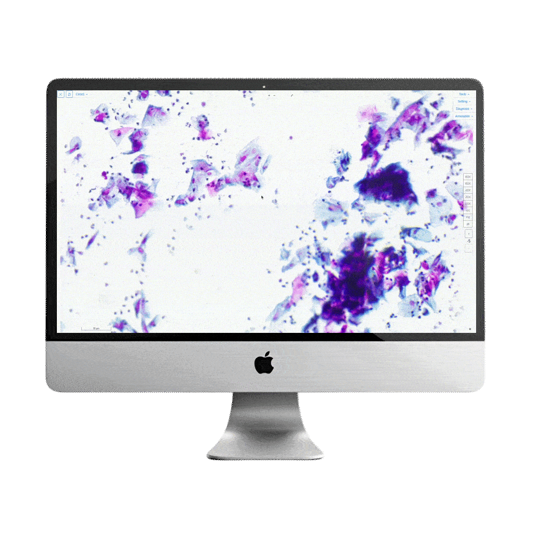 Micalys Whole Slide Scanner | Digital Microscope - Medprime